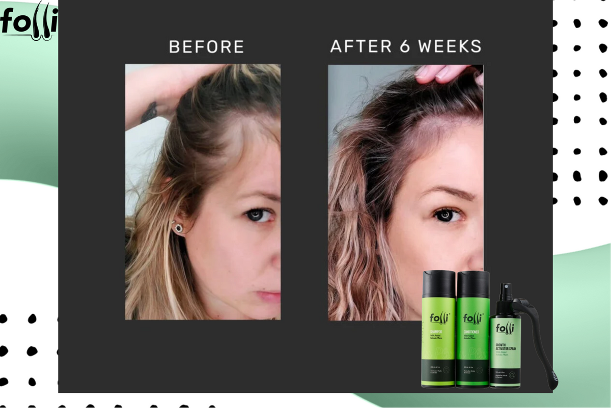 Hair Folli Customer Stories: Real Hair Growth Results & Transformation